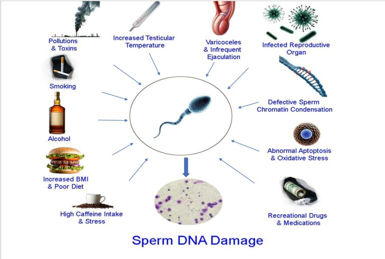 Sperm DNA damage can affect IVF pregnancy risks