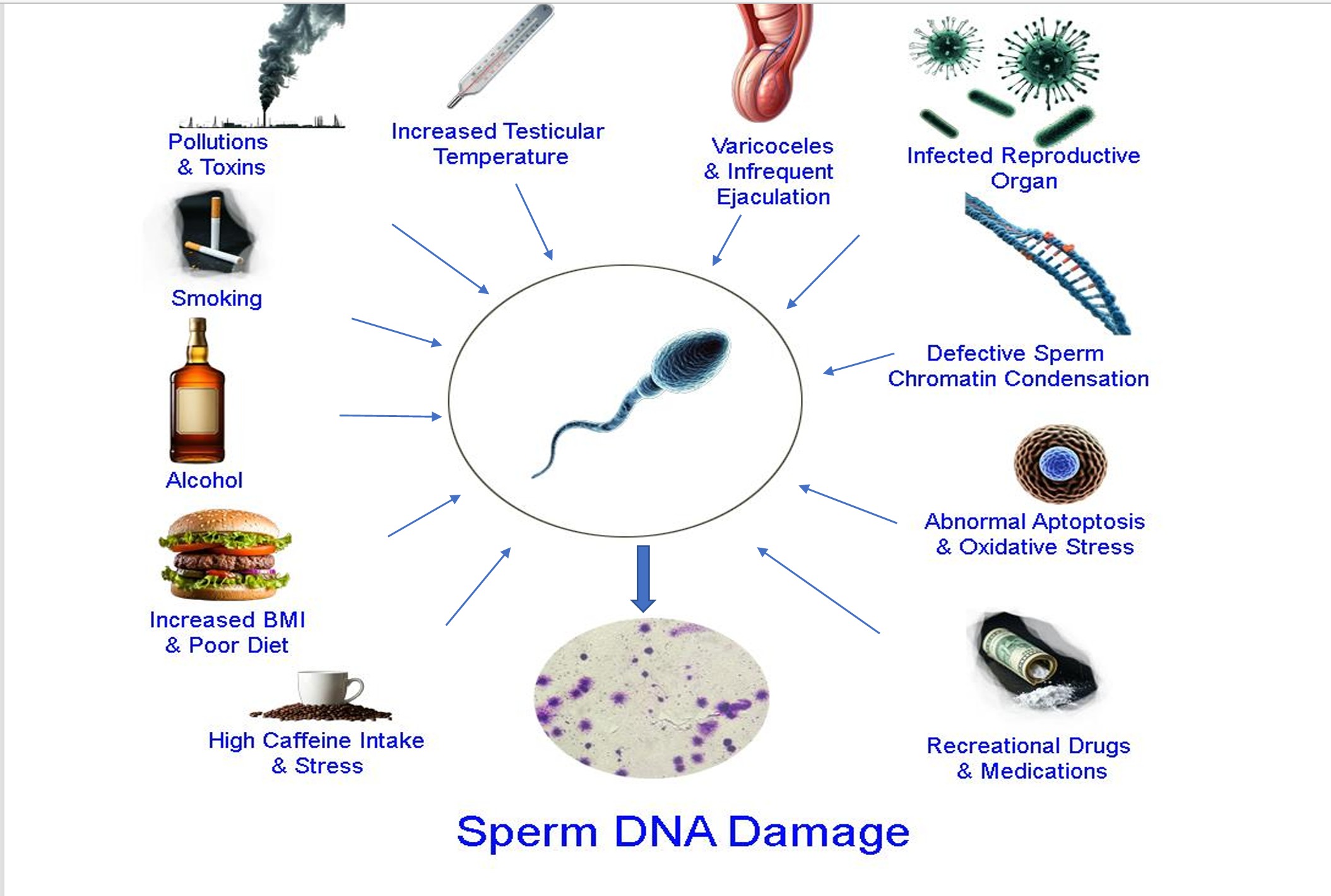 Sperm DNA damage can affect IVF pregnancy risks
